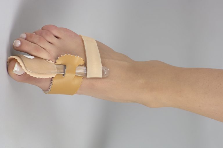 5 Hammertoe Correction Tips for Sweet Relief - Foot and Ankle Group