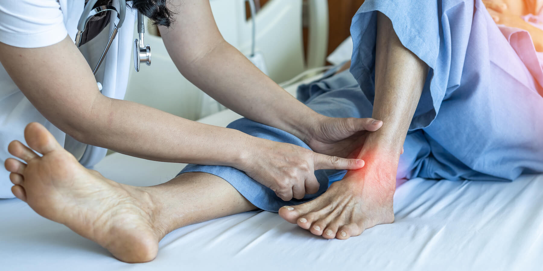 Foot Stress Fractures: Symptoms, Healing & Prevention - Foot and Ankle ...