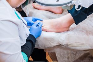 Signs Your Ingrown Toenail is Infected | Southwest Florida Podiatrist