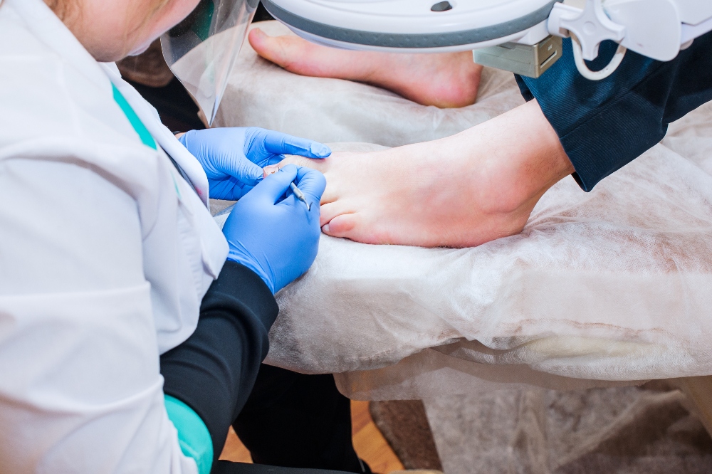Signs Your Ingrown Toenail is Infected | Southwest Florida Podiatrist