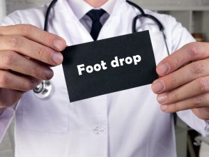 What is Foot Drop? Early Signs & Symptoms - Foot and Ankle Group
