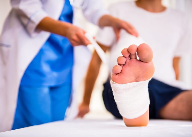 Cavus Foot: Understanding High-Arched Feet, Symptoms, and Treatment ...