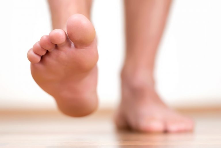Cavus Foot: Understanding High-Arched Feet, Symptoms, and Treatment ...